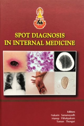 SPOT DIAGNOSIS IN INTERNAL MEDICINE - Ookbee ร้านอีบุ๊ค (E-Book) ครบ ...